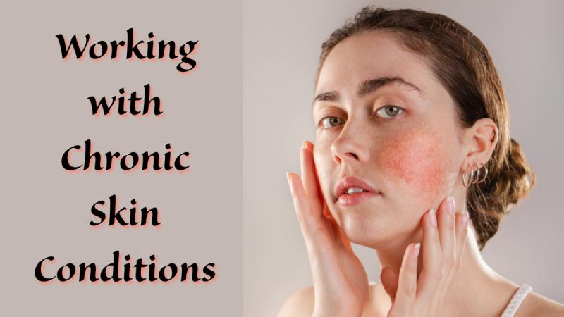 Working with Chronic Skin Conditions - Event - Stevenhorne.com